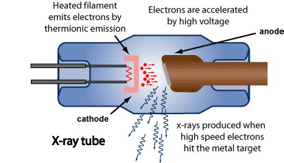 Explain The Different Types Of X Ray Tubes Mekhi Has Pratt