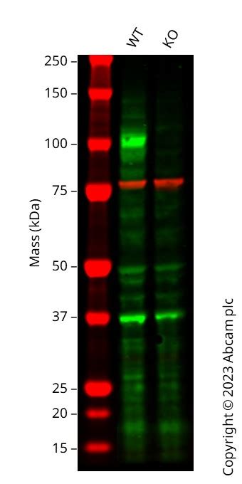 Anti Interferon Alphabeta Receptor 1 Antibody Epr6244 Ab124764 Abcam