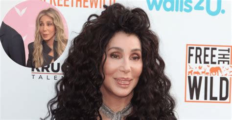 Fans Want Cher To Stop Plastic Surgery