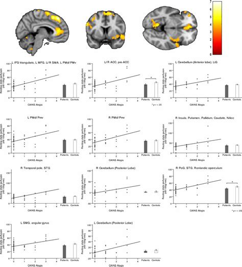 Resting State Perfusion Associated With Alogia Correlations Between Download Scientific