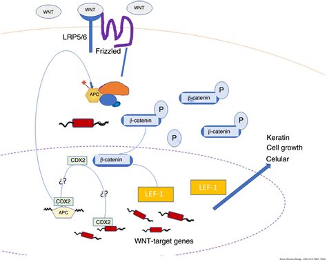 [translated Article] Usefulness Of Lef 1 Immunostaining For The Diagnosis Of Matricoma Actas