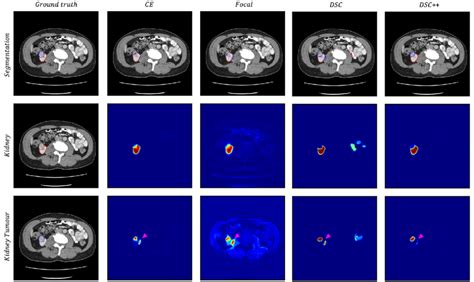 example segmentation with softmax predictions visualised as a heatmap