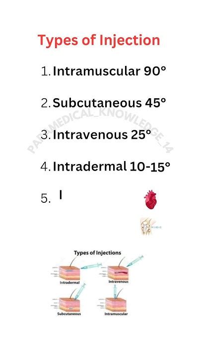 Injection Types Of Injection Site And Techniques Route And Site Of Injection Angle Youtube