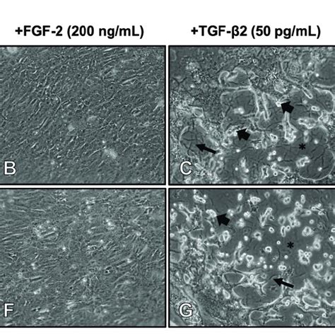 Fgf 2 Promotes A Spatially Dependent Tgf β2 Induced Emt Response In Download Scientific Diagram