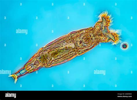 Rotifer Interphako Contrast Micrograph Of A Rotifer Phylum Rotifera