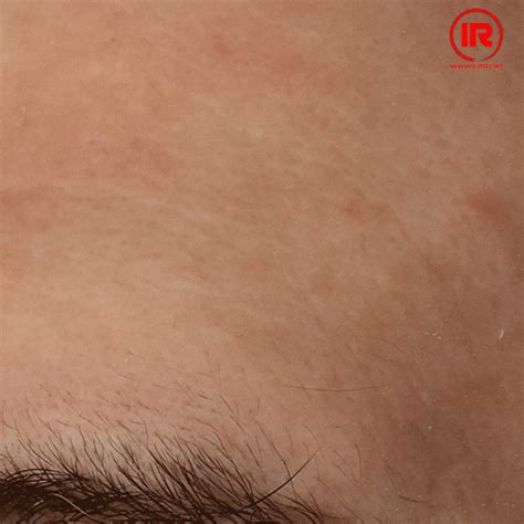 Skin  Find And Share On Giphy