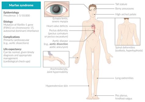 Advanced Pathophysiology Quiz 1 Flashcards Quizlet