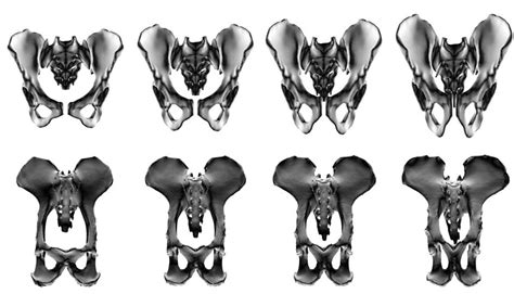 Where Do The Sex Differences In The Human Pelvis Come From