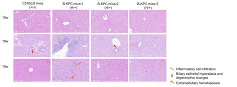 Kpc Mice Gene Humanized Mouse Models Biocytogen