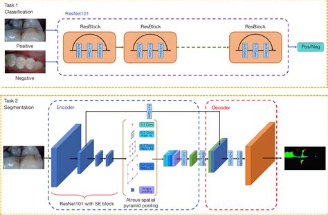 Figure 1 From A Deep Learning Model Using Convolutional Neural Networks For Caries Detection And