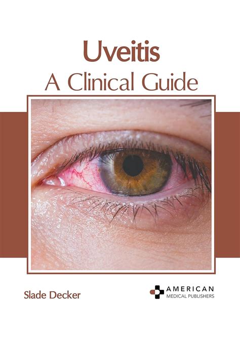 Uveitis A Clinical Guide 9798887405506 Medicine And Health Science