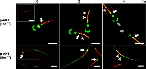 Subcellular Localization Of Phospho Akt During Sperm Capacitation