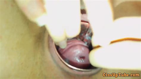 Cervix Show Eporner