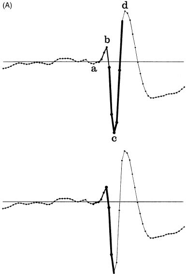 detection algorithm examples of identified waves and flanks on which