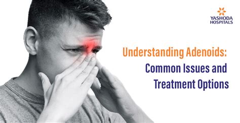 What Are Adenoids And Its Causes Symptoms Complications And Treatment