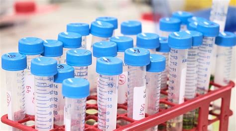 Buy Human Synovial Fluid For Research Synovial Fluid Samples