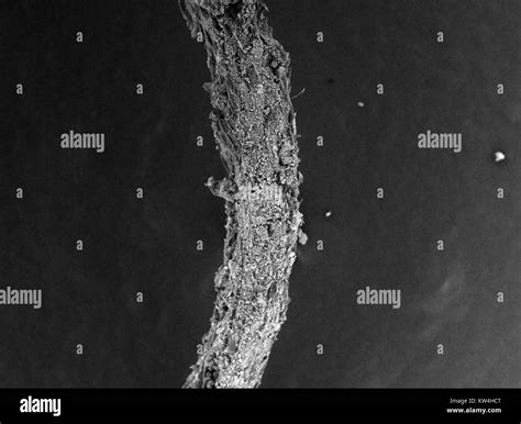 Root Hairs Microscope