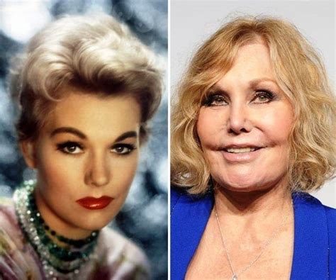 Nose Insecurity Xnxx Adult Forum