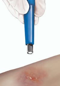 FFPE Tissue For Biomarkers High Throughput Proteomics Workflow Wiley Analytical Science