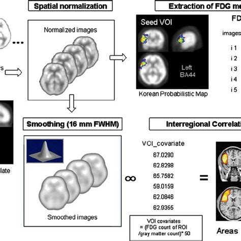 PDF Metabolic Connectivity By Interregional Correlation Analysis Using Statistical Parametric