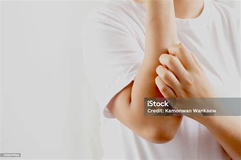 피부 로션 알레르기로 인해 여성 가려운 팔 건선에 대한 스톡 사진 및 기타 이미지 건선 건강관리와 의술 건강한 생활방식 Istock