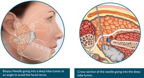 Parotid Space Diagram