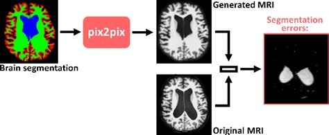 Figure 1 From A Deep Learning Based Pipeline For Error Detection And Quality Control Of Brain