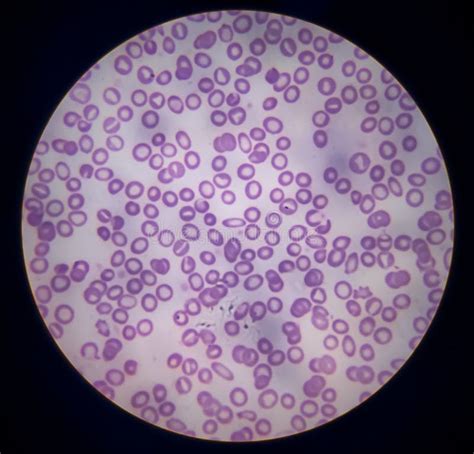 Blood Under Microscope