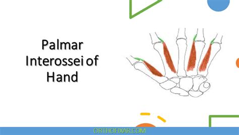 Palmar Interossei Of Hand Orthofixar
