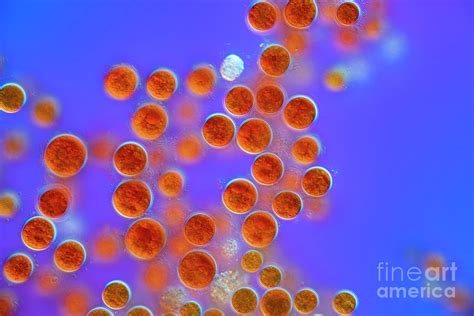 Haematococcus Sp Photograph By Frank Foxscience Photo Library Pixels