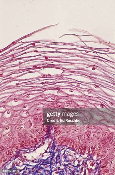 Epithelial Tissue With Label