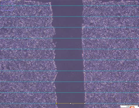 手把手教学——划痕实验（细胞迁移）的实验流程及经验分享 哔哩哔哩
