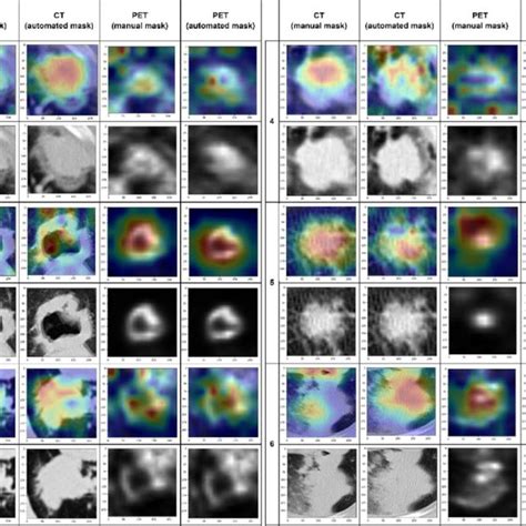 Grad Cam Results Heatmaps Generated Using The Grad Cam Algorithm With