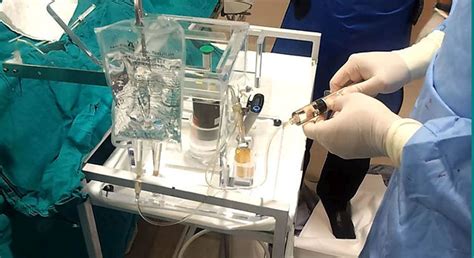 Radioembolization Tare Sirt Y90 In Cancer