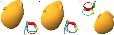 Short Crp For Anterior Canalithiasis A New Maneuver Based On