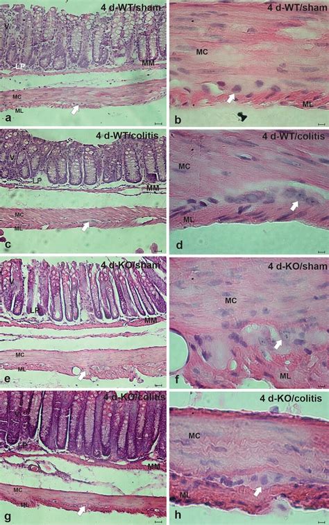 Photomicrographs Showing Hande Stained Sections Of The Myenteric Plexus