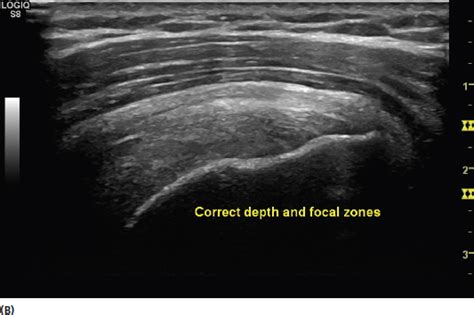 Image Optimization Radiology Key