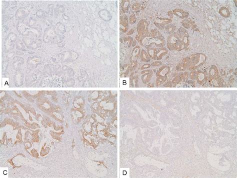 Figure 1 From Correlation Between Cox 2 And Apc Expression In Left