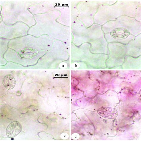 Anatomical Features Of Stressed And Unstressed Soybean Root And Stem