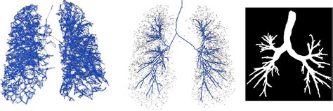figure 3 from graph refinement based airway extraction using mean field