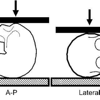Test Setup Schematics For Heads Compressed In The Anterior Posterior