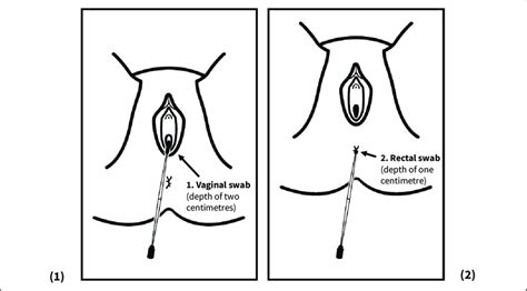 Specimen Collection Instructions For Determining Gbs Colonization Of