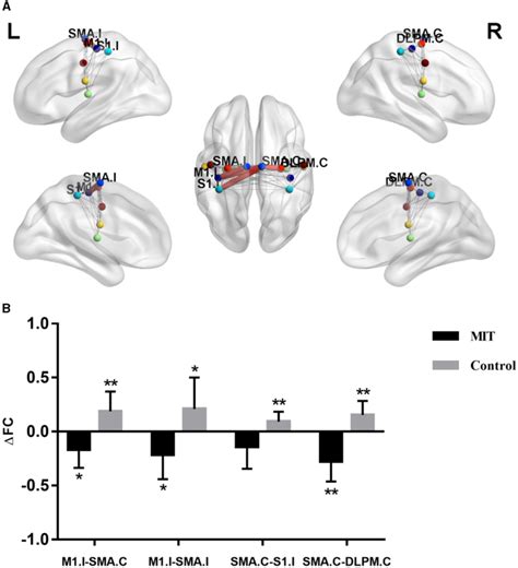 Figure 1 From Motor Imagery Therapy Improved Upper Limb Motor Function In Stroke Patients With