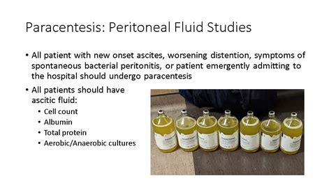 Is Ascites Peritoneal Fluid