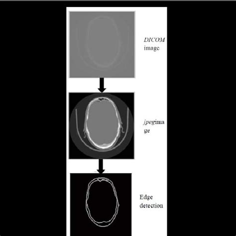 Stepwise Results Image Processing Download Scientific Diagram