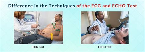 Are Echo And Ecg Tests Same Know Their Difference Ganesh Diagnostic