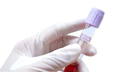 EDTA Podcast Chemistry World