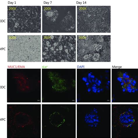 Immunofluorescence Expression Of Sle X And Muc1 Ema In Breast Impc And Download Scientific