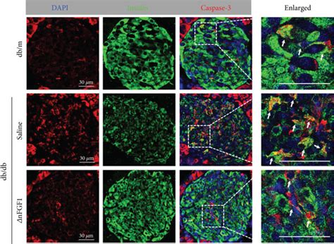 ∆nfgf1 relieves β cell apoptosis in db db mice a hande staining of download scientific diagram