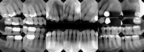 Jazz Solo Sensor Jazz Imaging